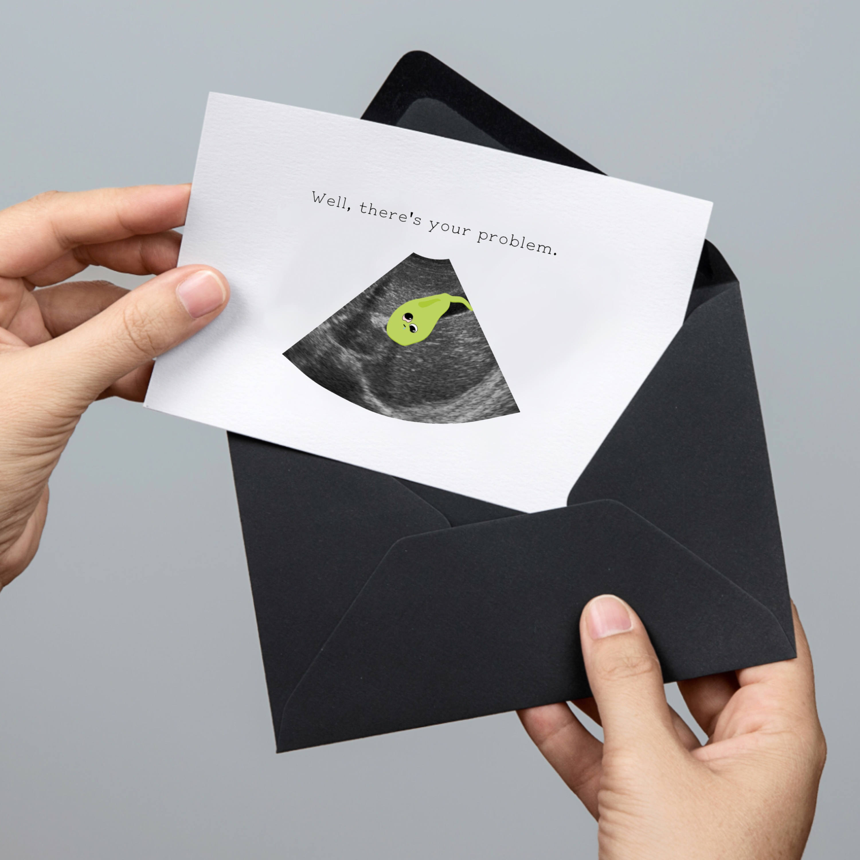 Gallbladder Surgery Card (ultrasound Cholecystectomy Get Well Greeting ...