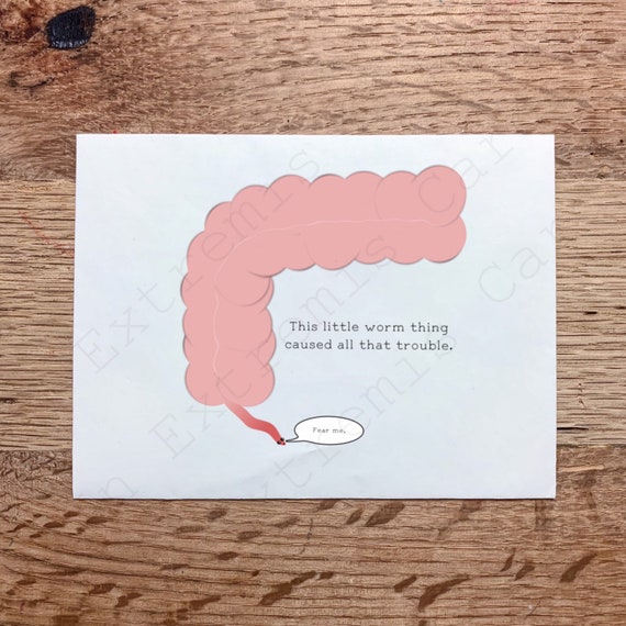 Appendicitis Memes Funny Appendicitis Surgery Gift Appendix" Art