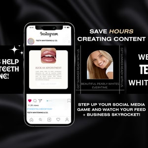 240 Teeth Whitening Instagram Templates | Teeth Whitening Instagram ...
