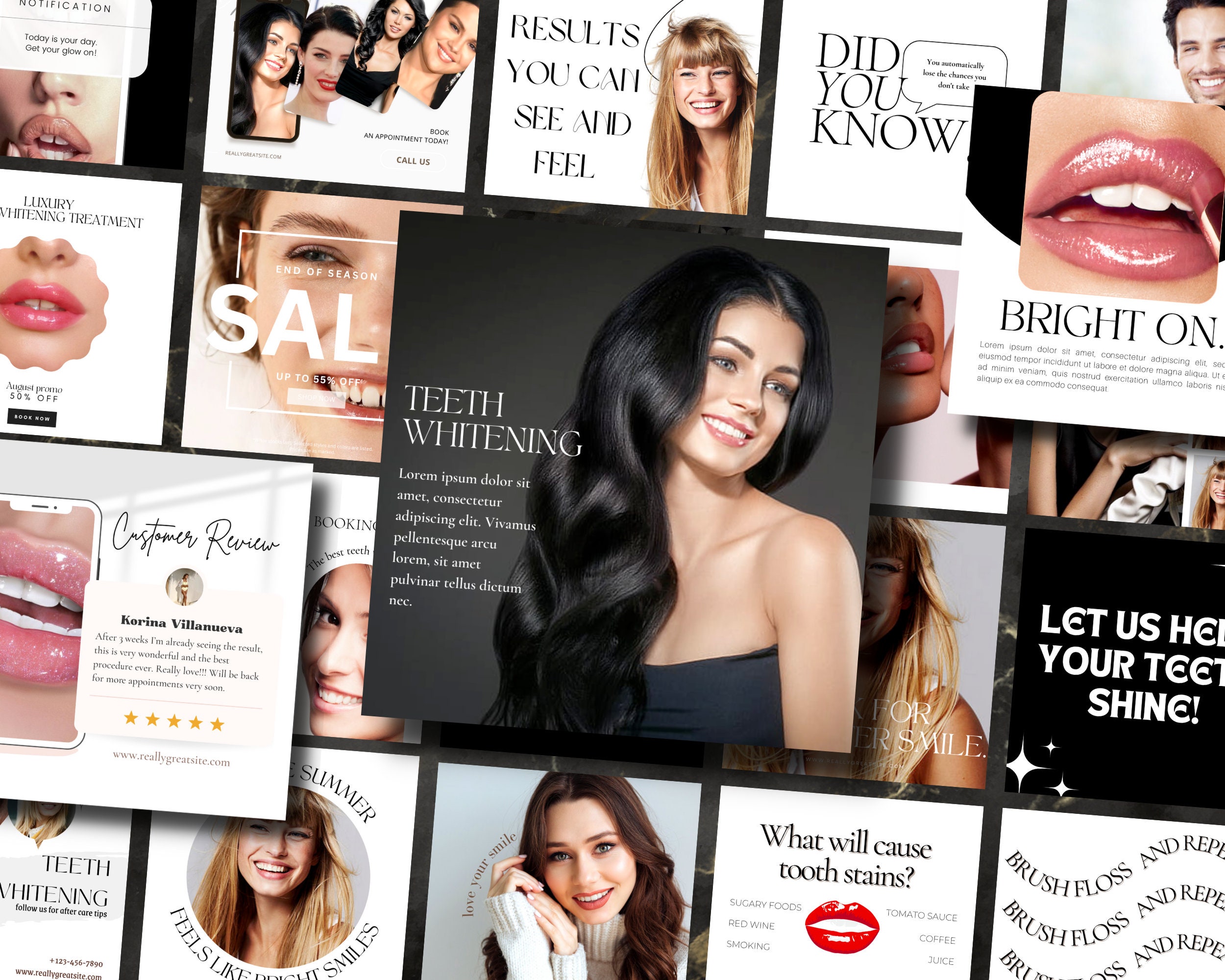 240 Teeth Whitening Instagram Templates Teeth Whitening Instagram ...