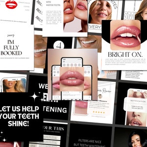 240 Teeth Whitening Instagram Templates | Teeth Whitening Instagram ...