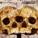 Conjoined Twins Human Skull **FREE SHIPPING* - Etsy
