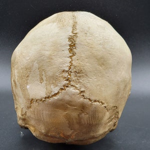 Sun Bleached Resin Human Skull Replica ***free Domestic Shipping *** - Etsy