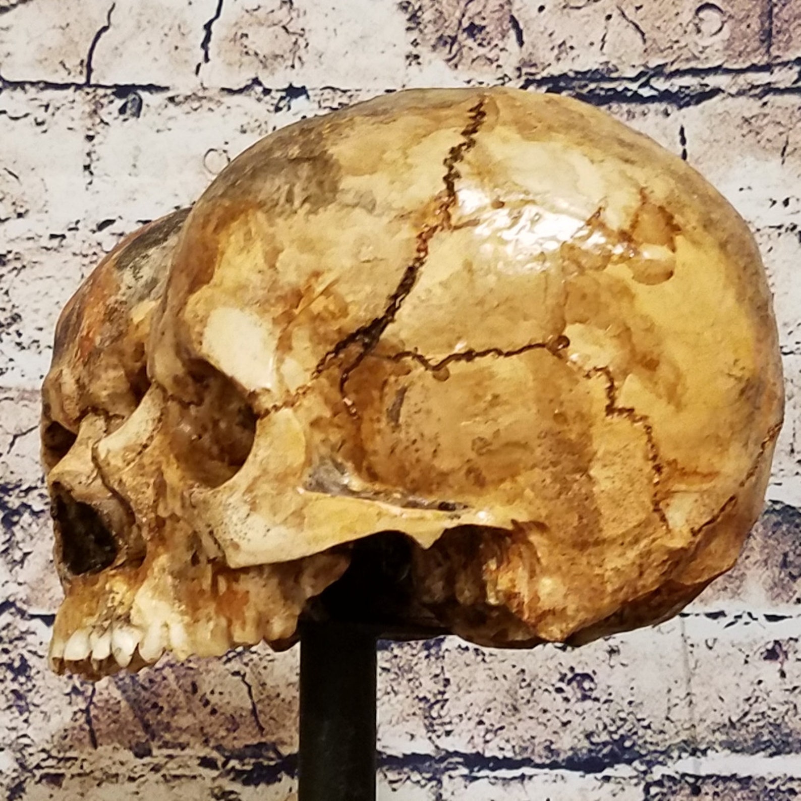 Conjoined Twins Human Skull FREE SHIPPING - Etsy