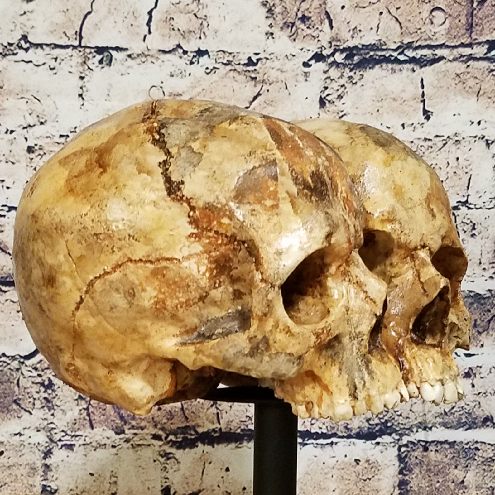 Conjoined Twins Human Skull FREE SHIPPING - Etsy