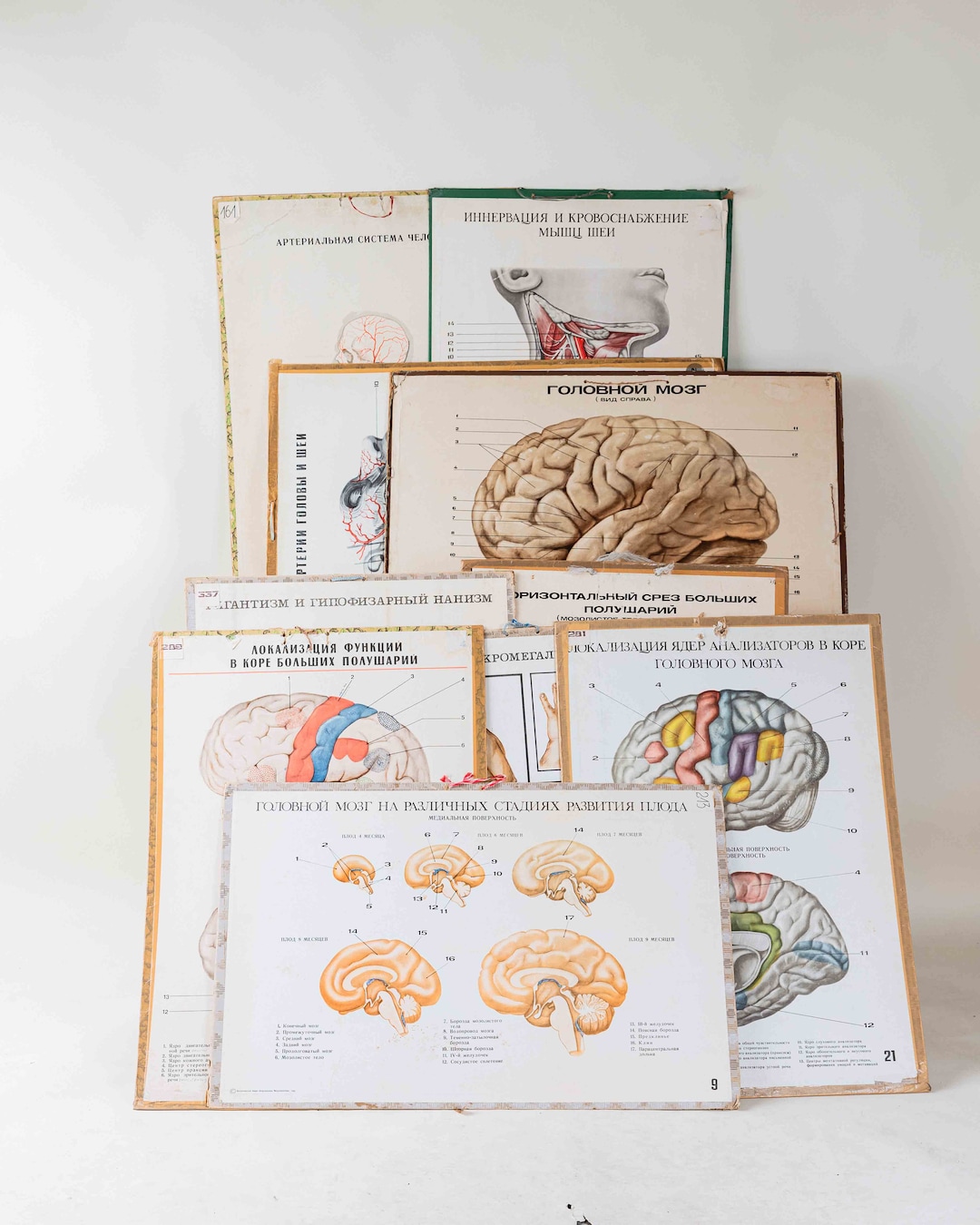 Vintage Large Anatomical USSR Posters- Original Vintage Brain Skeleton ...