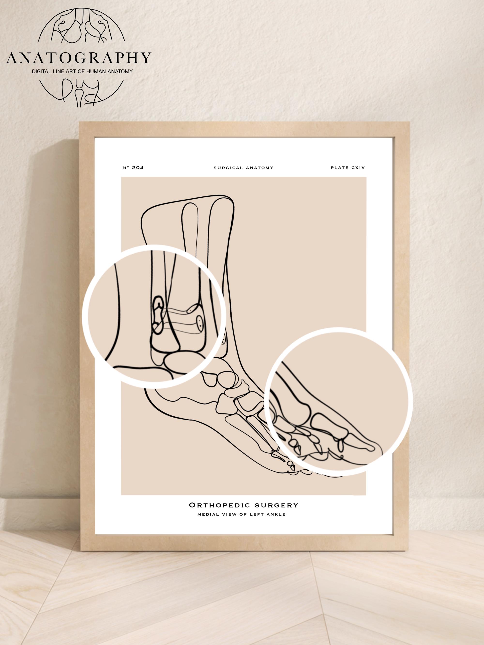 Orthopedic Surgery Anatomy Print | 18x24 Digital Poster of Medial Left ...