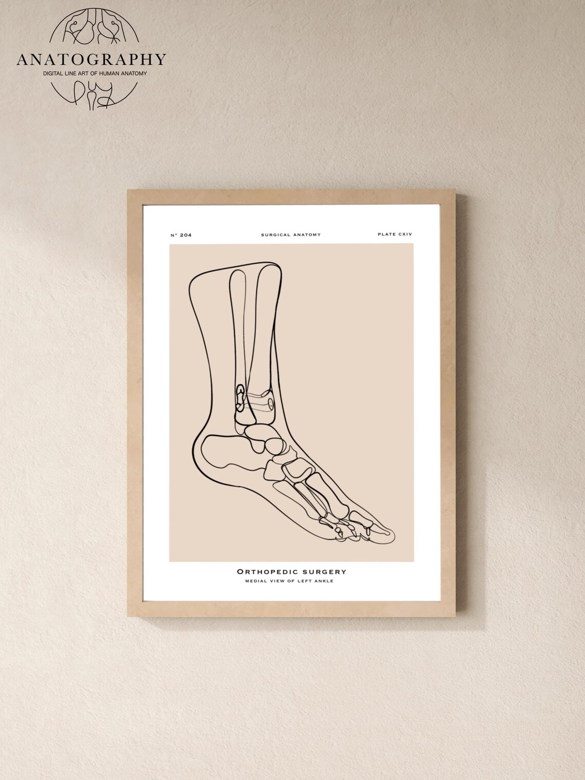 Orthopedic Surgery Anatomy Print | 18x24 Digital Poster of Medial Left ...