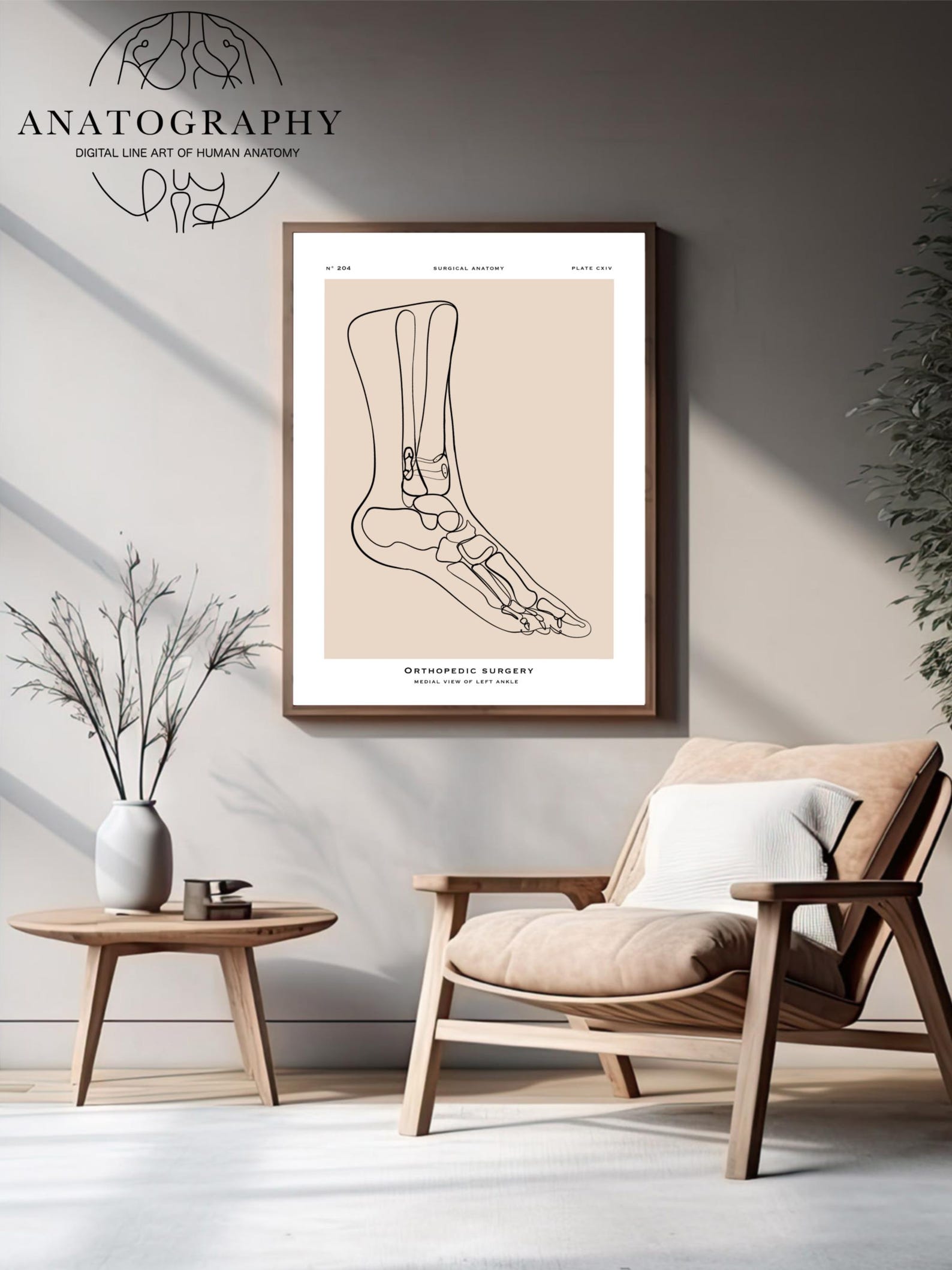 Orthopedic Surgery Anatomy Print | 18x24 Digital Poster of Medial Left ...