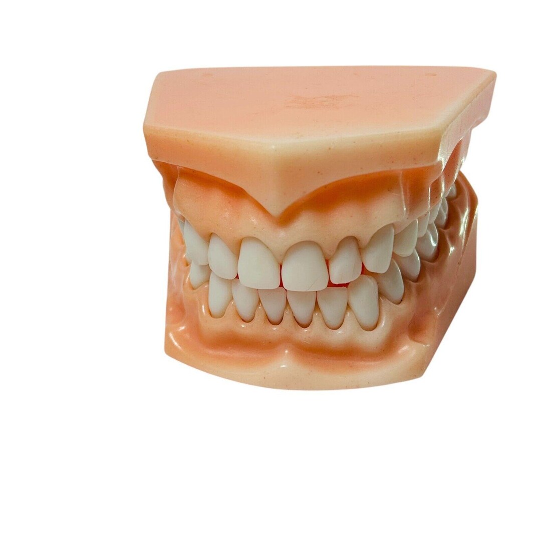 Vintage Dentist Dental Standard Teeth Model Gums Hinged Plastic Display ...