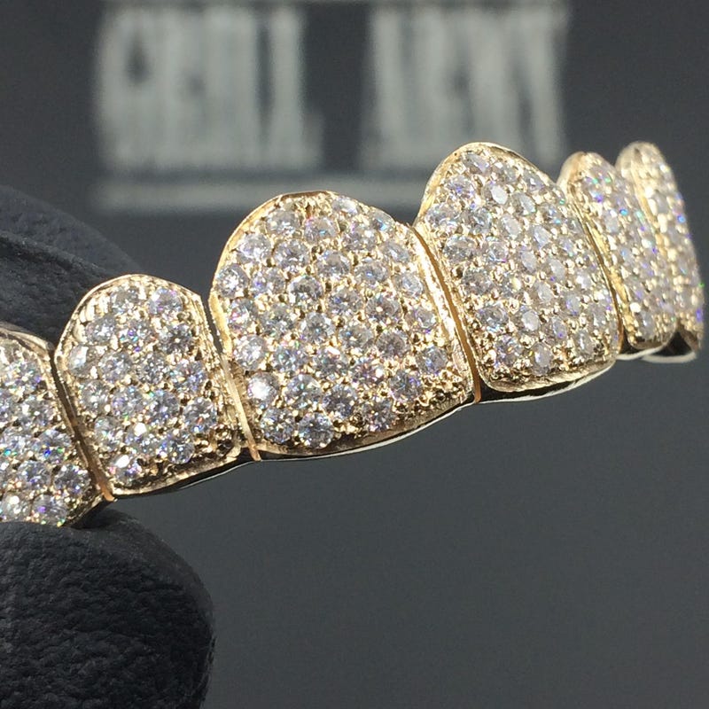 Diamond Grillz for Kids - Etsy