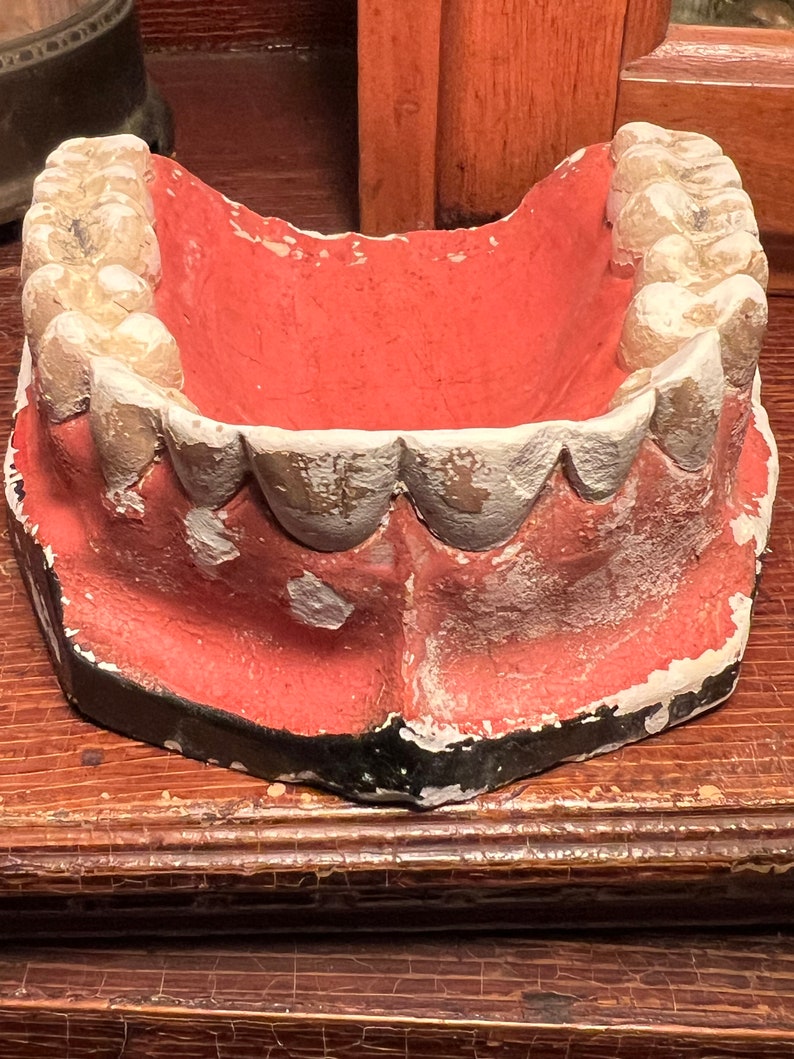 Antique Plaster Orthodontal Dental Model - Dentist Teaching Mold ...