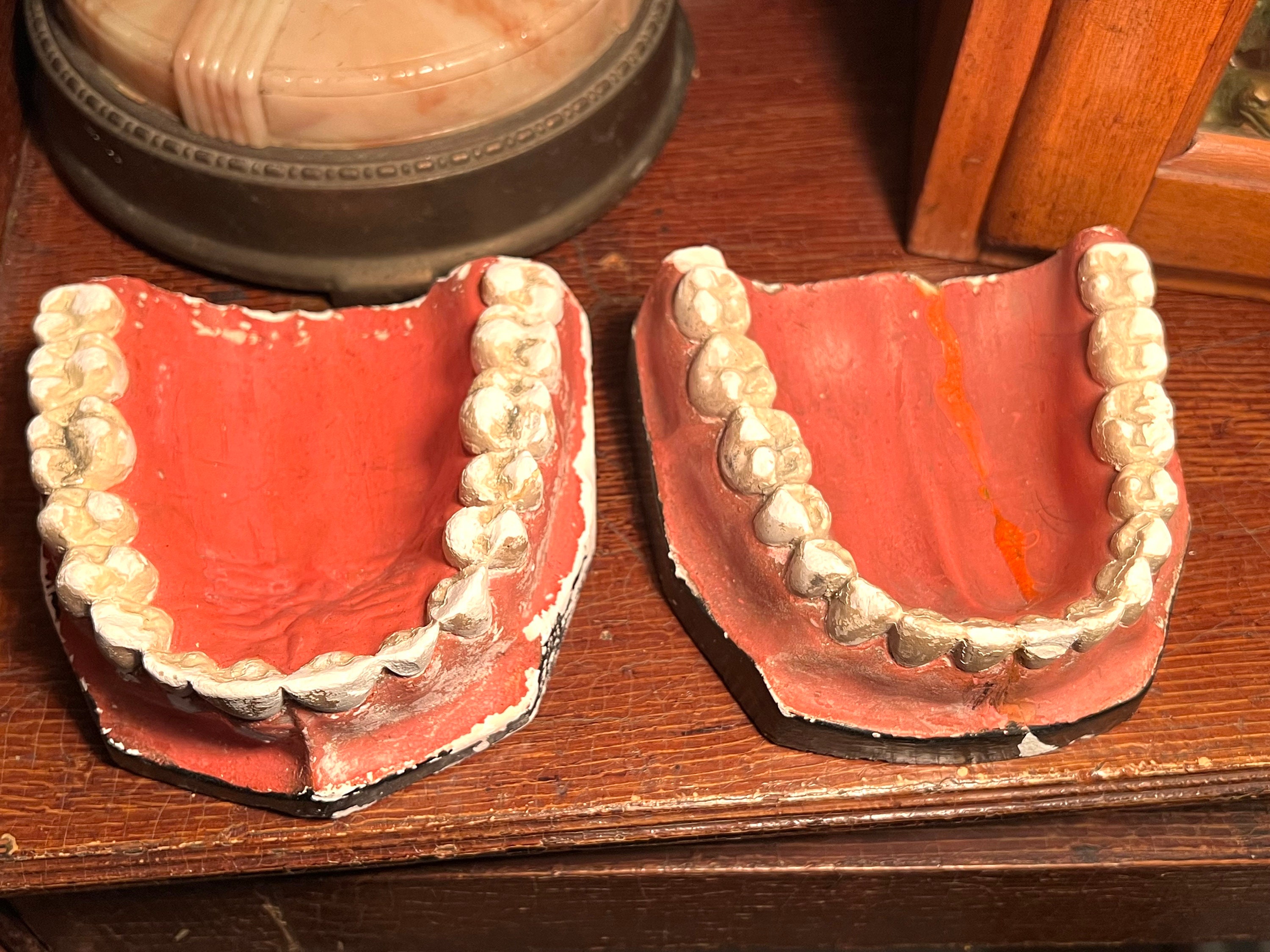Antique Plaster Orthodontal Dental Model Dentist Teaching Mold Vintage ...