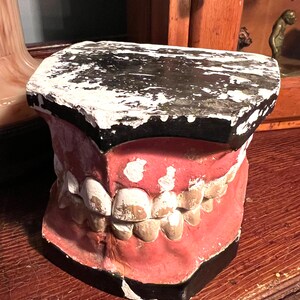 Antique Plaster Orthodontal Dental Model - Dentist Teaching Mold ...
