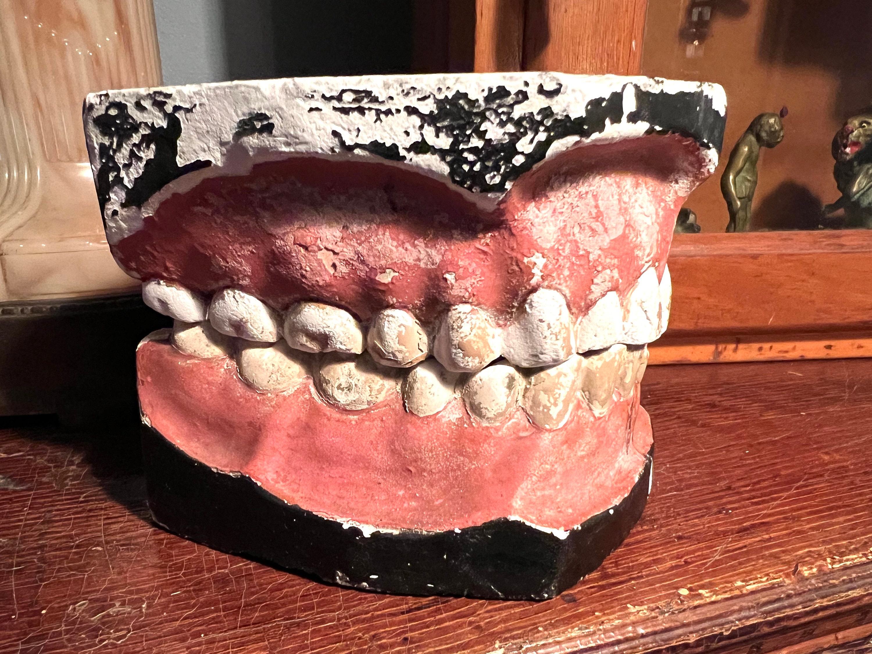 Antique Plaster Orthodontal Dental Model Dentist Teaching Mold Vintage ...