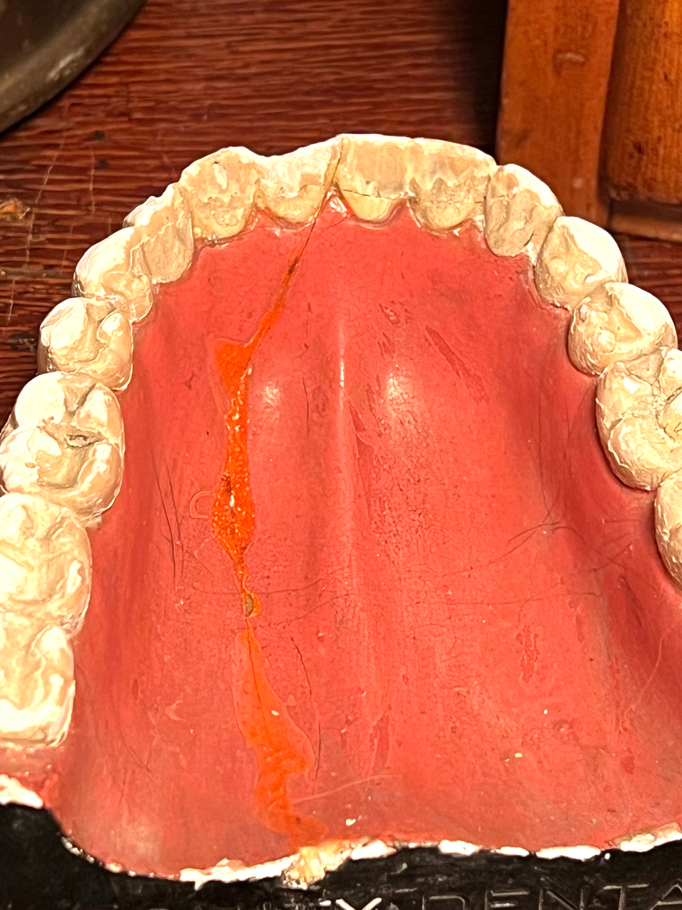 Antique Plaster Orthodontal Dental Model Dentist Teaching Mold Vintage ...