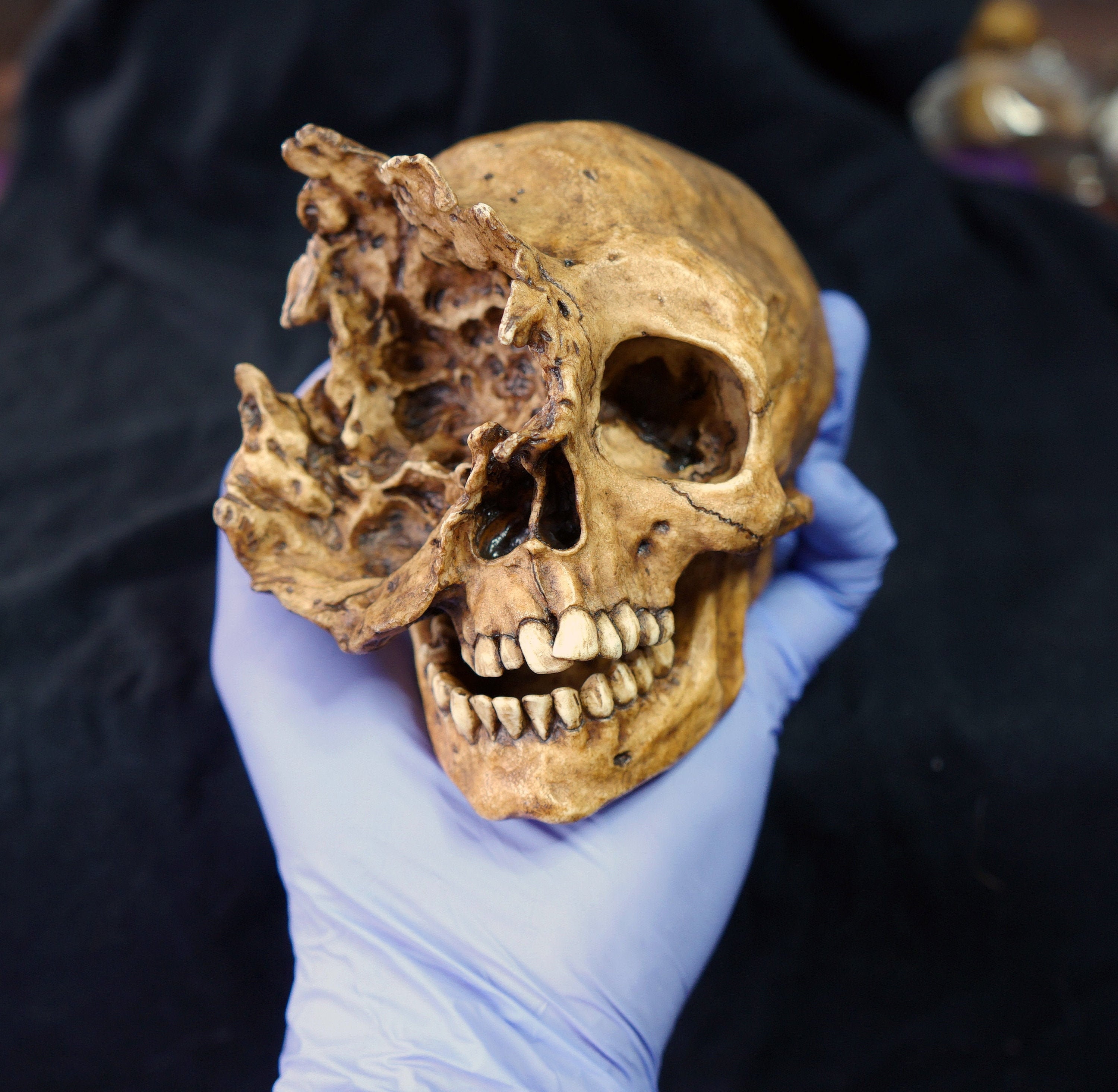 Exploded Skull - Etsy