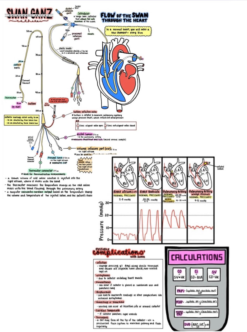 Pulmonary Artery (swan-ganz) Catheter Notes - Etsy
