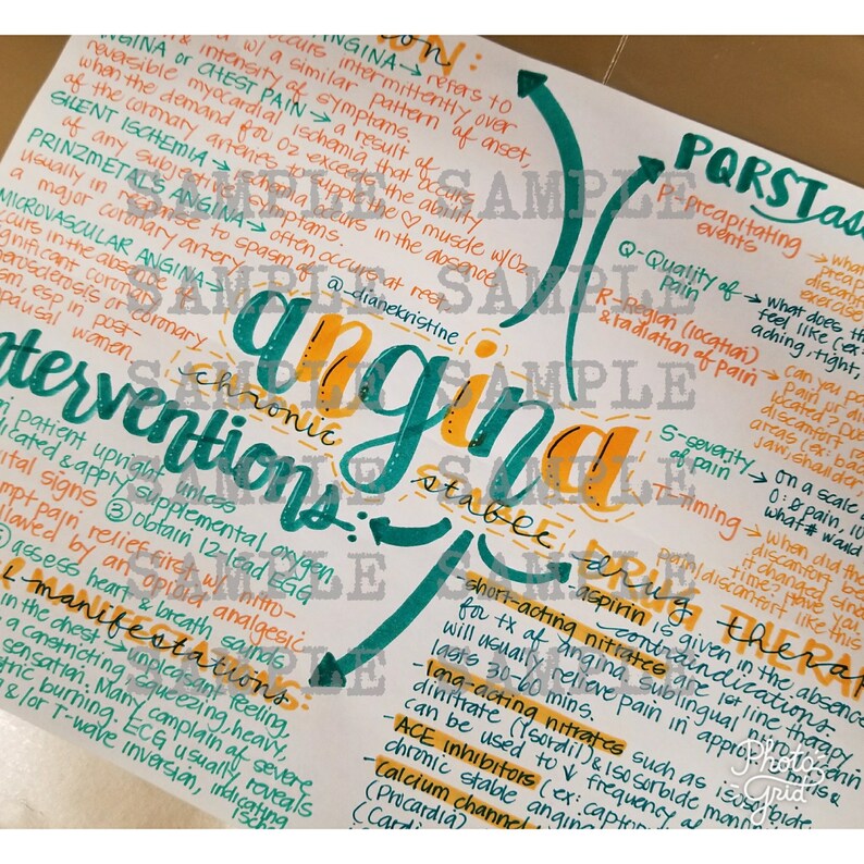 Angina Chronic Stable- Nursing Notes/ Concept Map- Medical Surgical ...