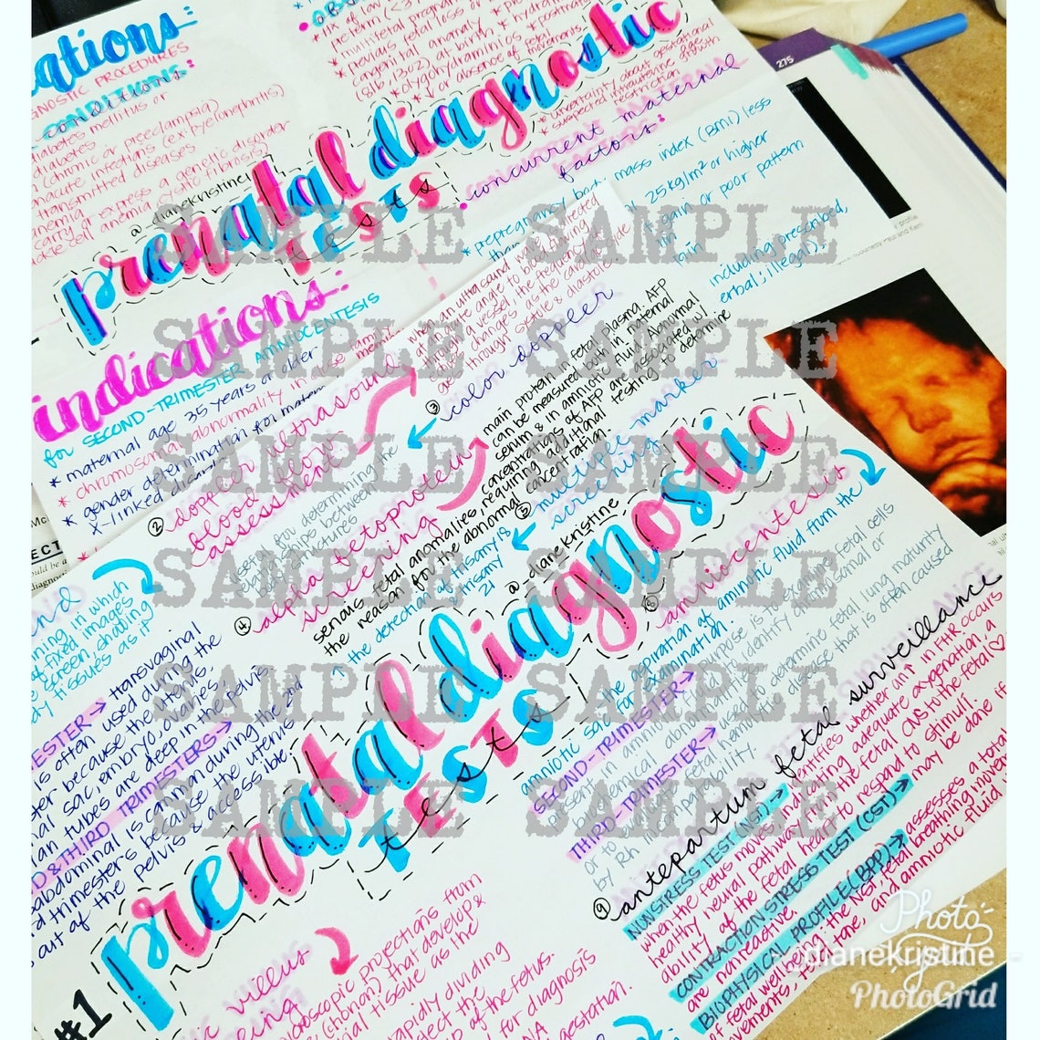 OB Unit 1 Bundle (6 Pages) - Nursing Notes- Maternal Child OB Semester ...