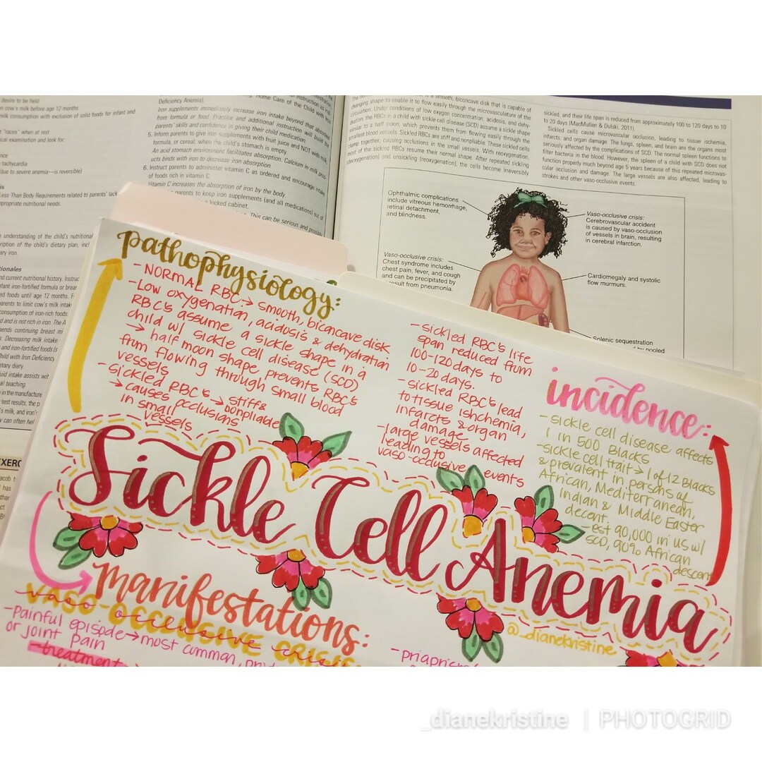 Sickle Cell Anemia- Nursing Notes/ Concept Map- Pediatrics Semester - Etsy