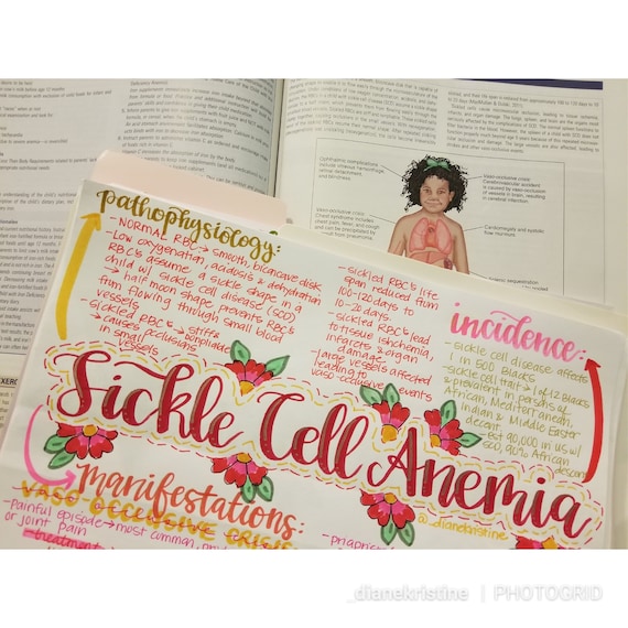 Sickle Cell Anemia Nursing Notes/ Concept Map Pediatrics - Etsy