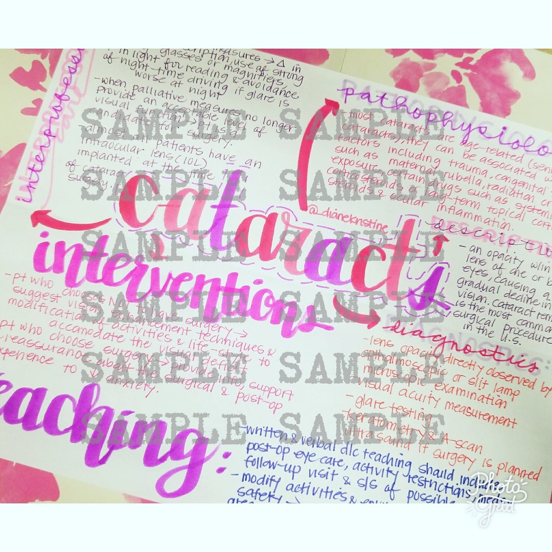 Cataracts- Nursing Notes/ Concept Map- Medical Surgical Semester - Etsy