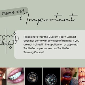 Custom Tooth Gem Kit - Etsy