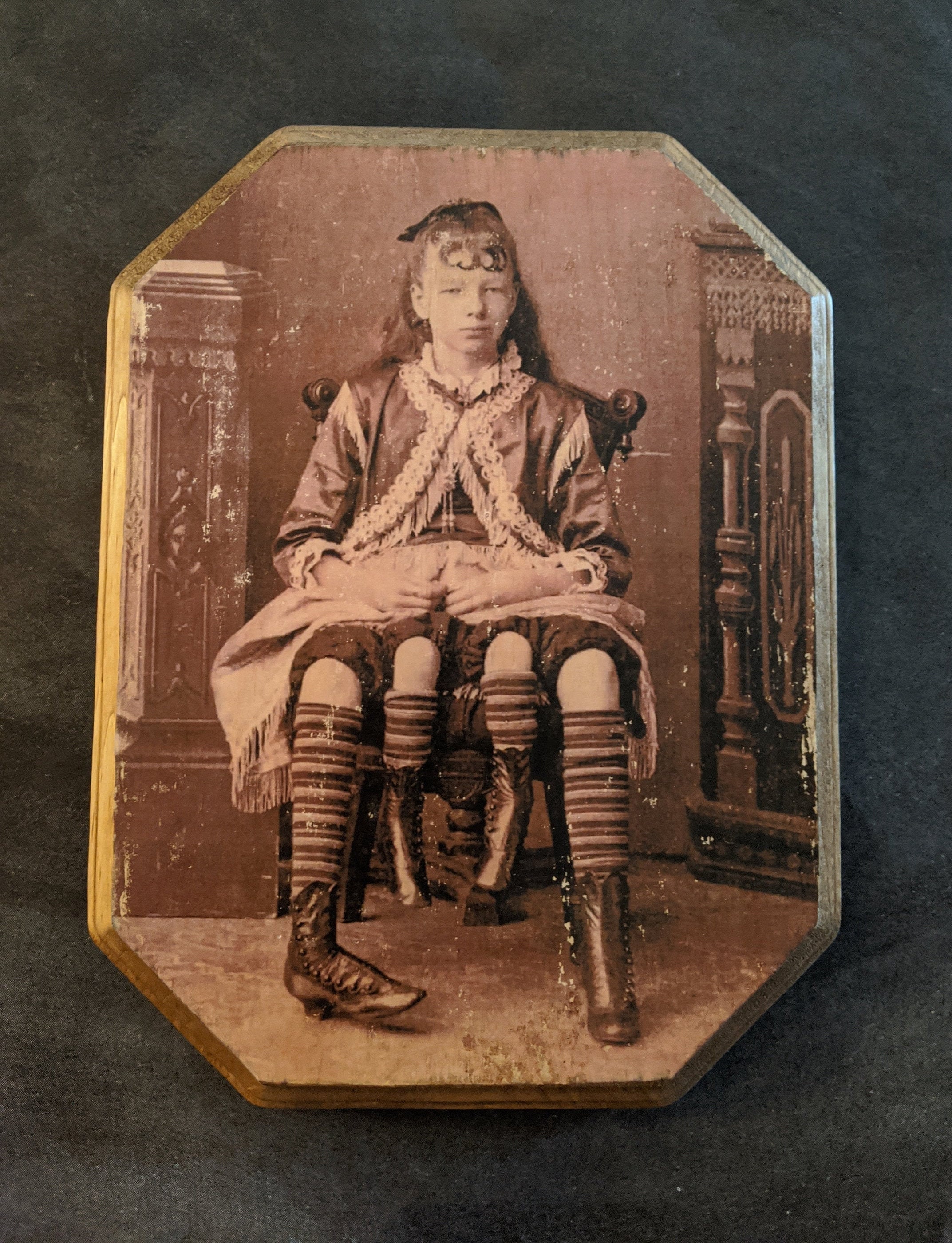 Myrtle Corbin 4 Legged Girl Freak Show Sideshow Vintage Art | Etsy