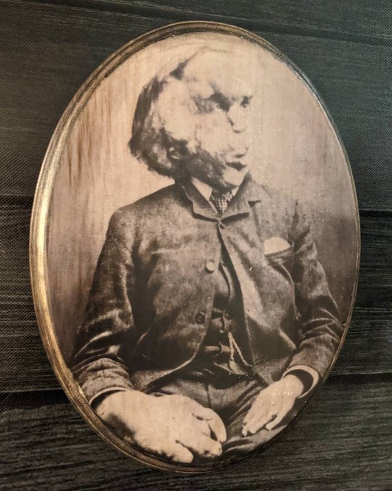 Joseph Merrick