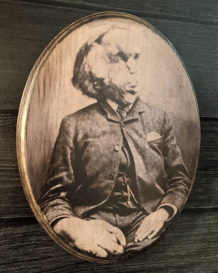 Joseph Merrick Tattoos