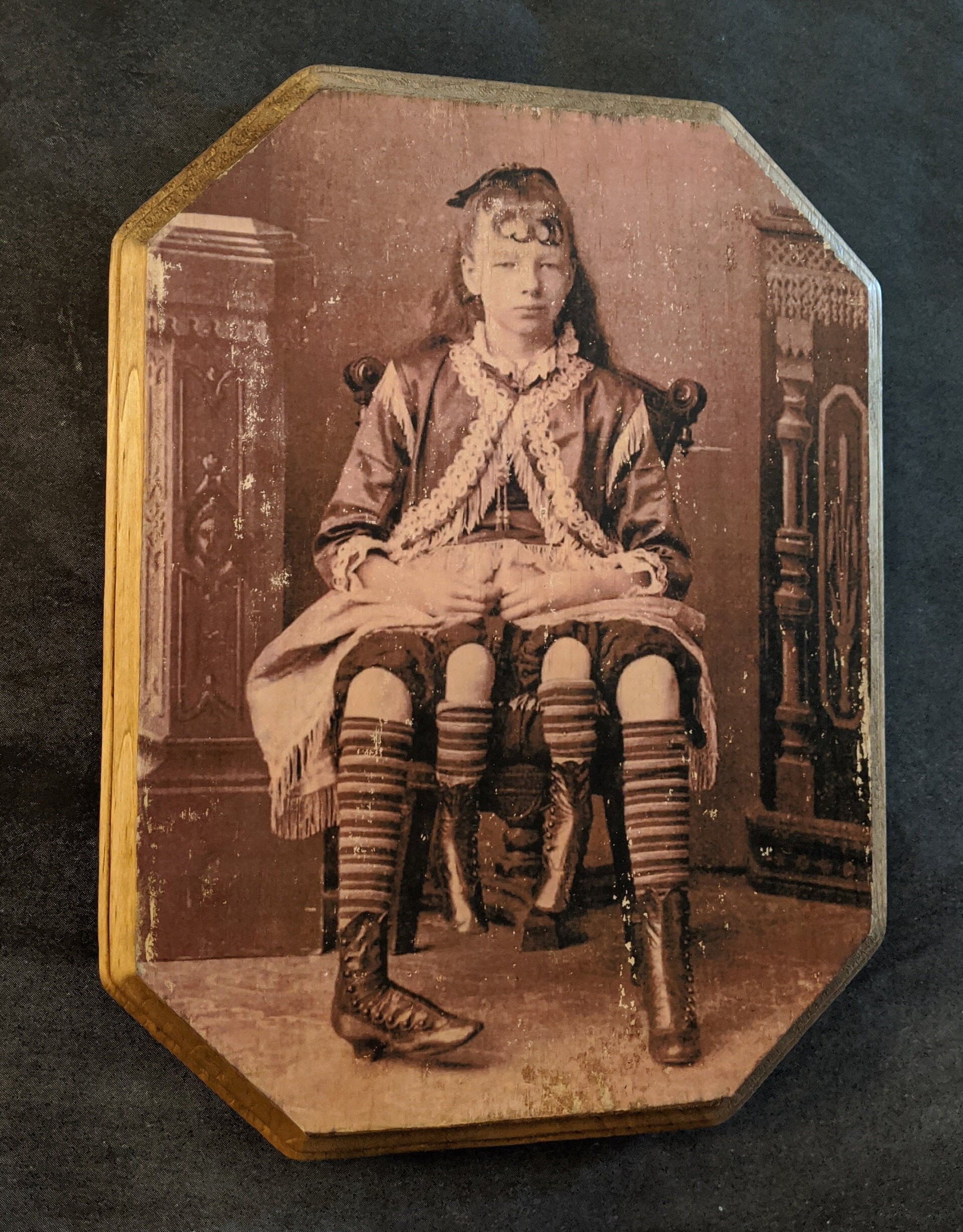Myrtle Corbin 4 Legged Girl Freak Show Sideshow Vintage Art | Etsy