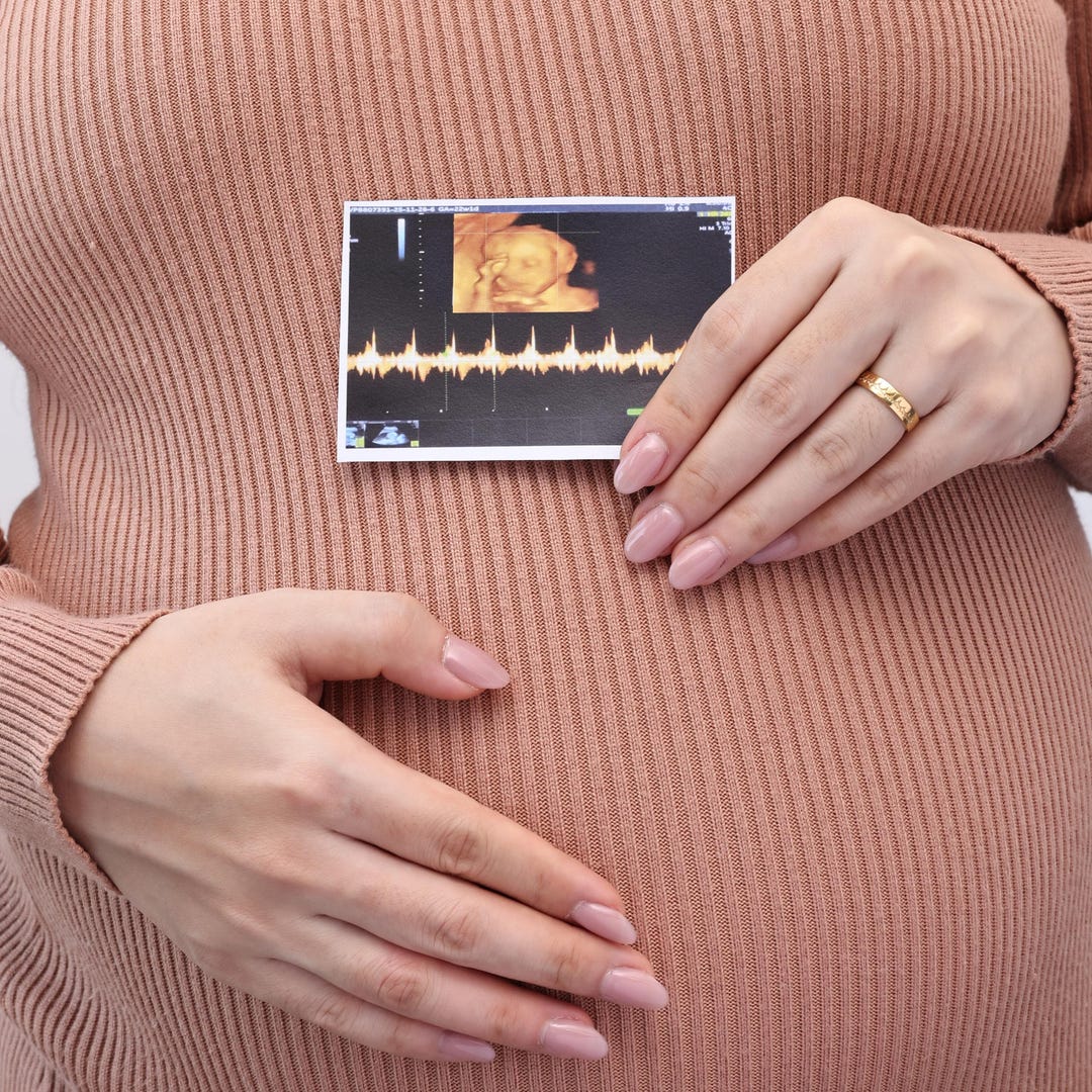 Custom EKG Heartbeat Ring - Ultrasound Pregnancy Keepsake - Mother’s ...