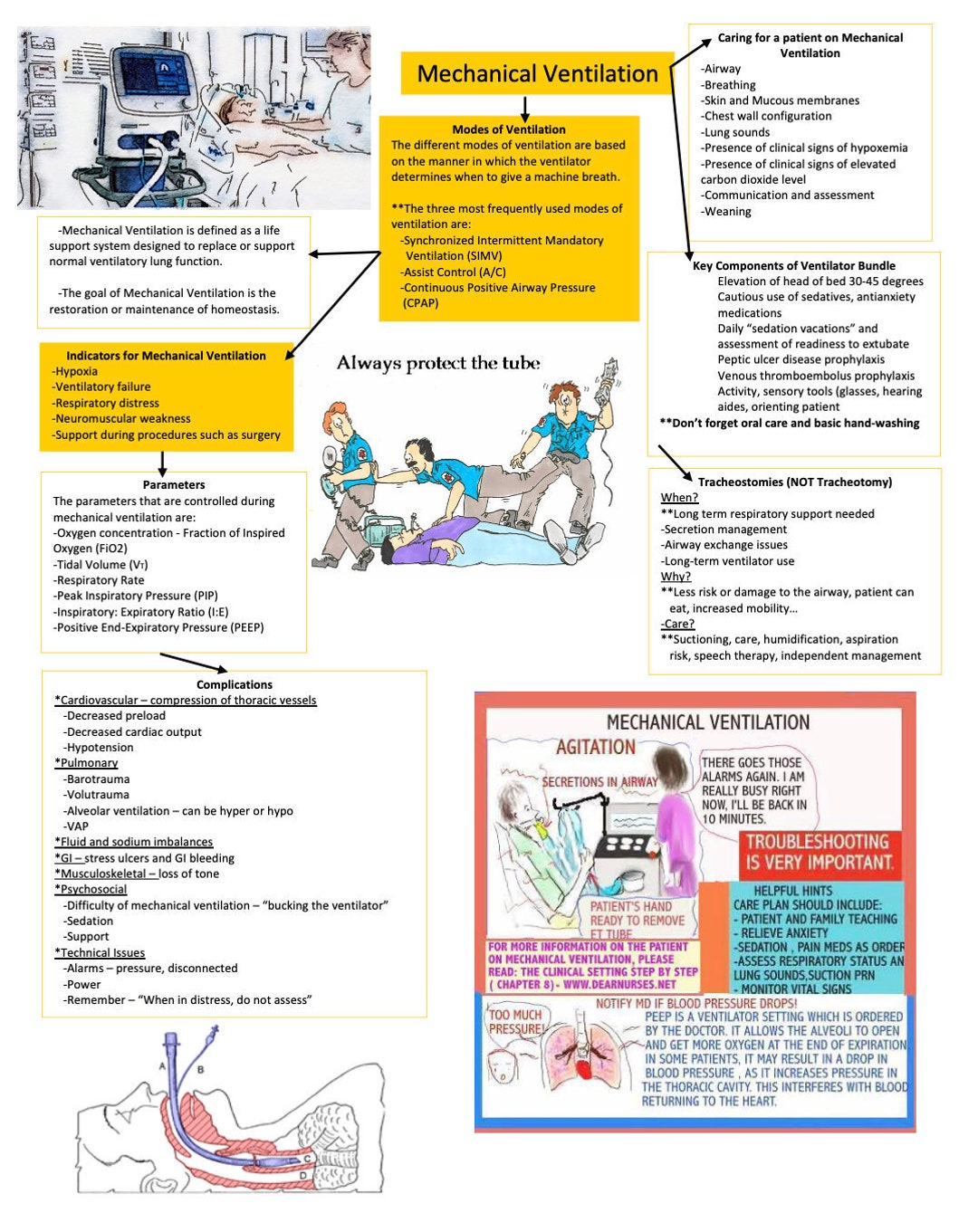 Mechanical Ventilation/ventilation/asthma/copd/tb/pneumonia/nursing ...
