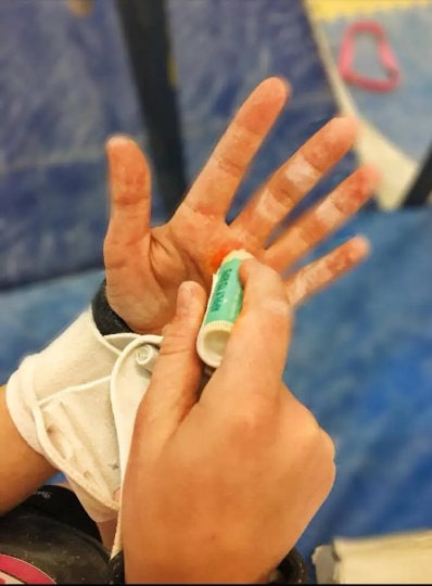 The Rip Stick, Natural First Aid Salve for Gym Skin Issues Made With ...