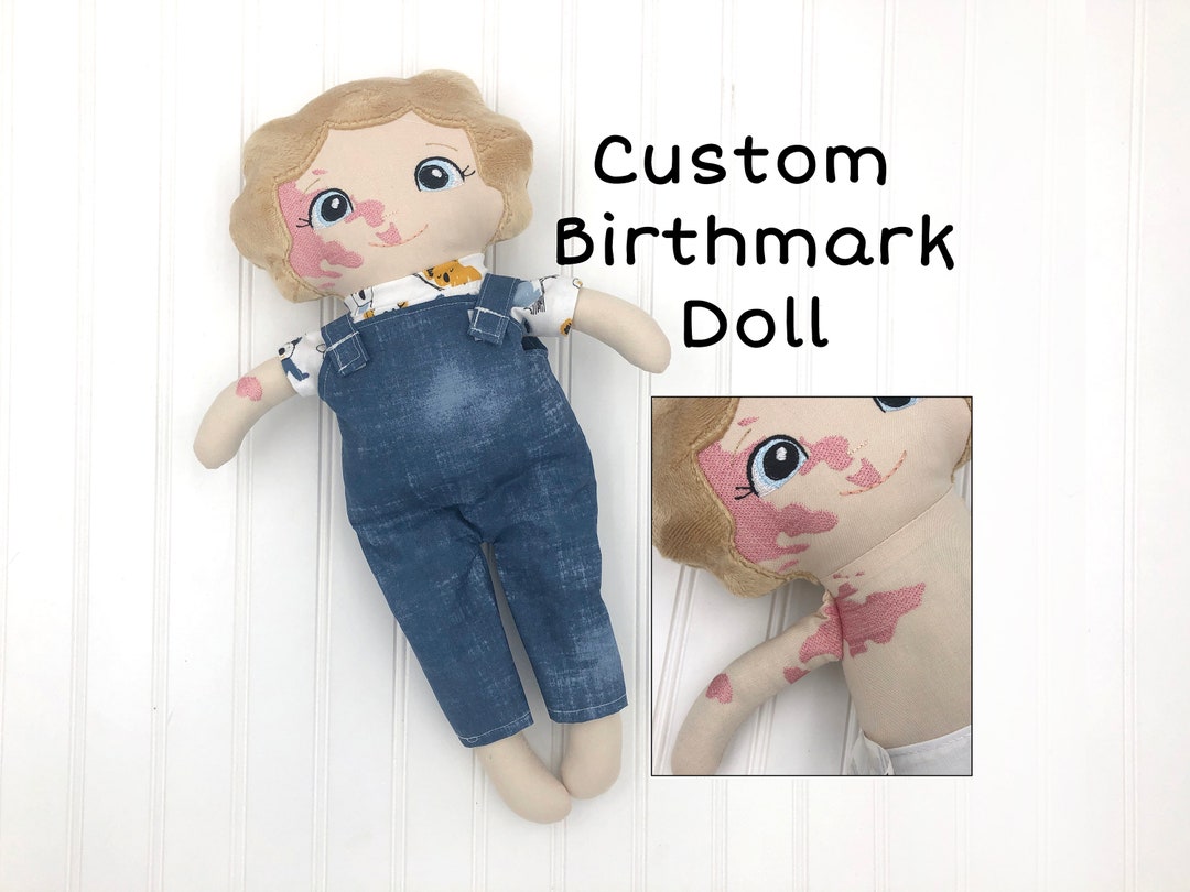 Custom Birthmark Doll for Boy, Port Wine Stain Doll, Hemangioma Look ...