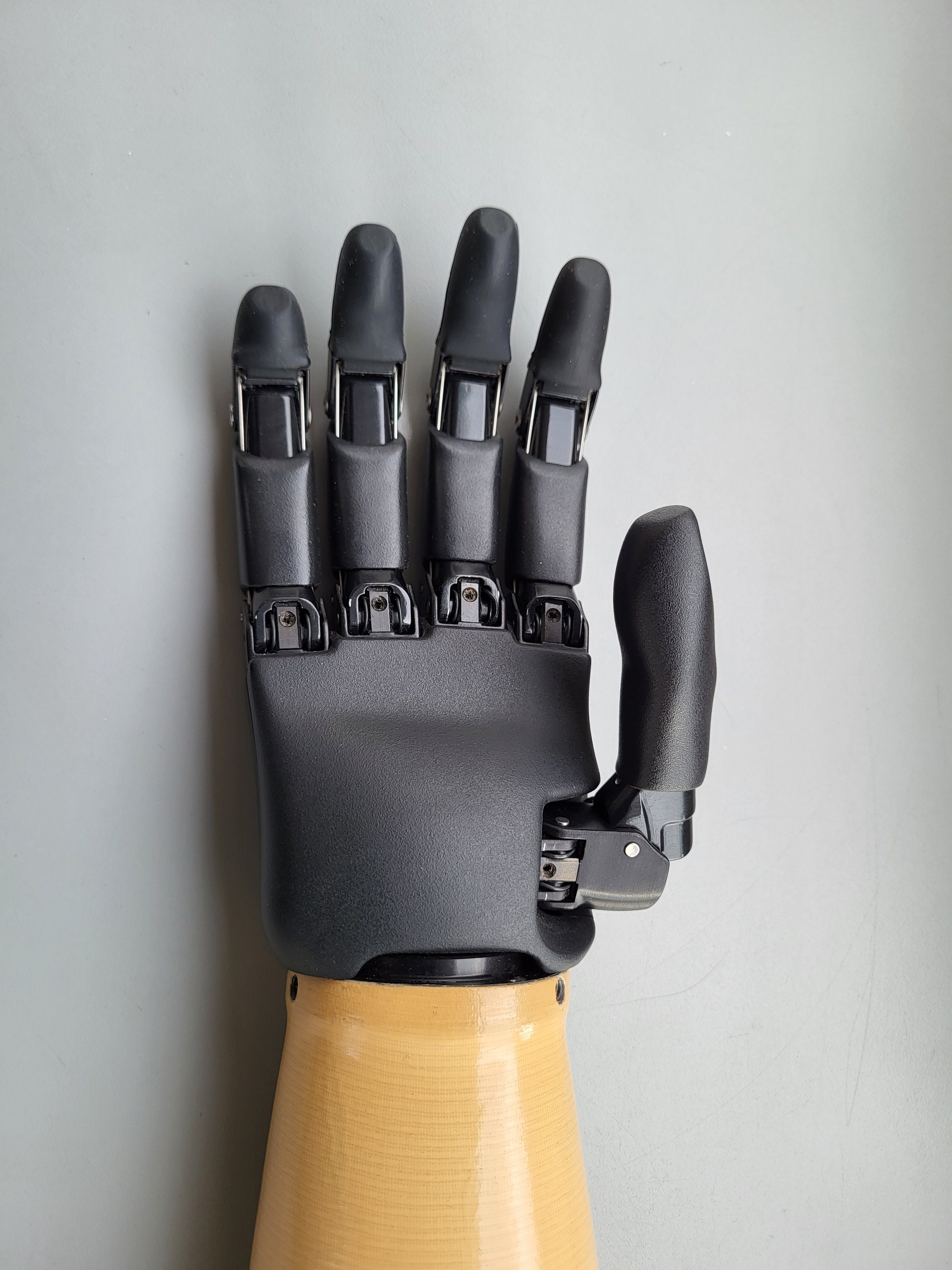 Prosthetic Arm Vincent Evolution 3 German Prosthetic Arm New Working ...