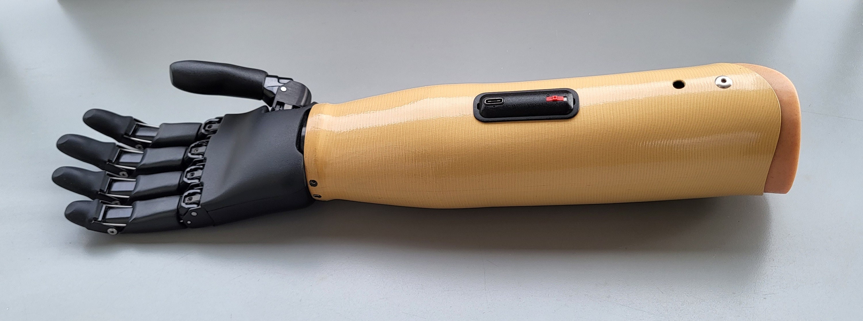 Prosthetic Arm Vincent Evolution 3 German Prosthetic Arm New Working ...