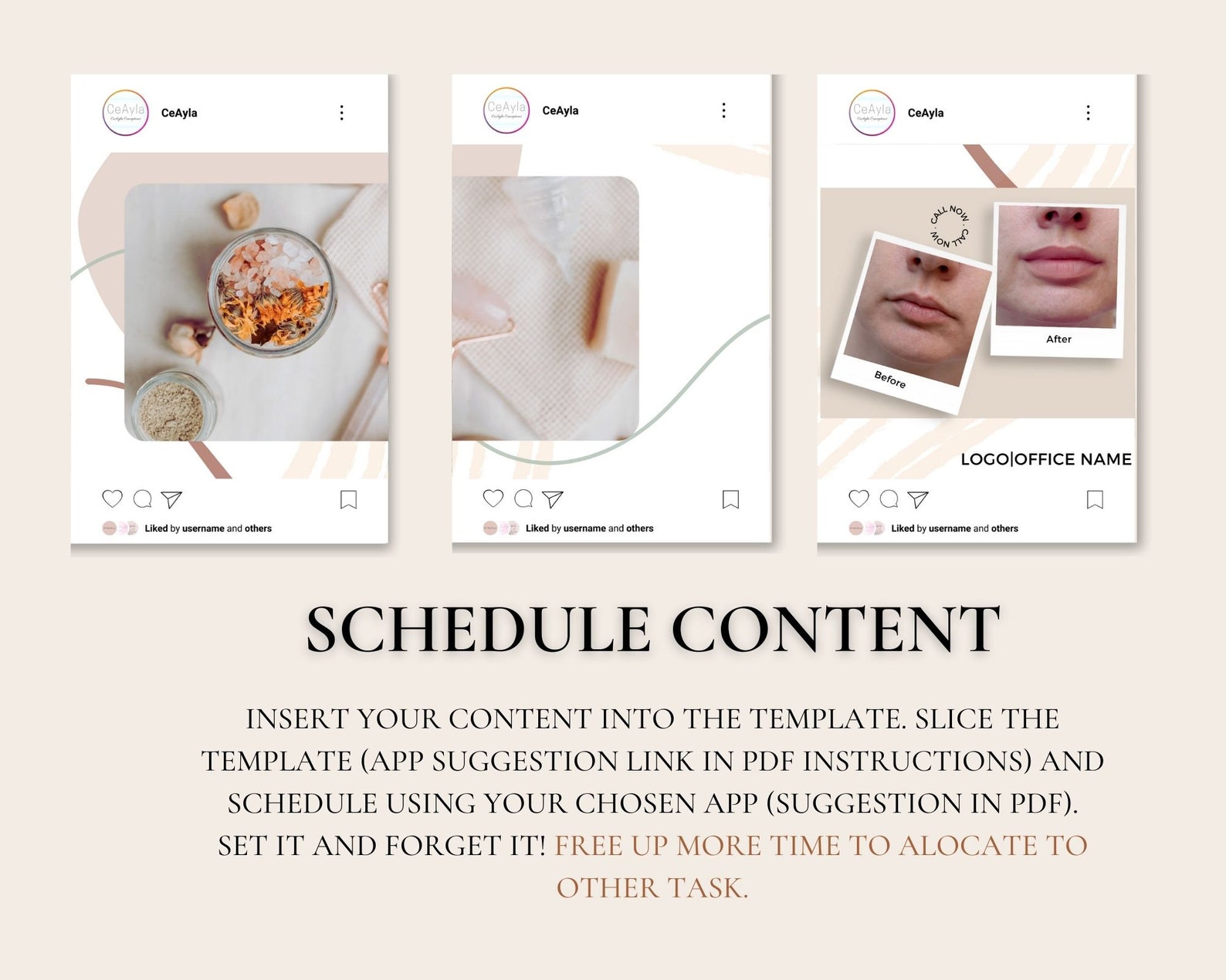 Nurse Injector Templates Botox and Filler Instagram Posts Anti Wrinkle ...