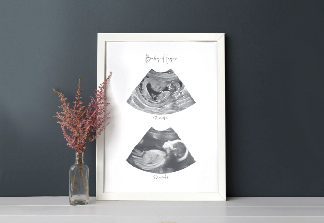 Personalised Baby Scan Print, Grey Nursery Print, Grey Nursery Decor ...