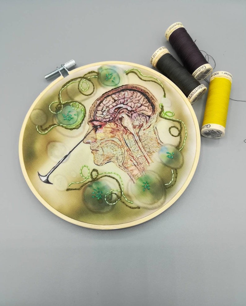 LOBOTOMY Embroidery Art Vintage Medical Illustration Original - Etsy