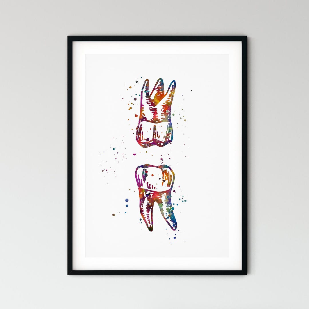 Watercolour Molar Anatomy Print, Tooth Roots Poster, Dental Clinic Wall ...