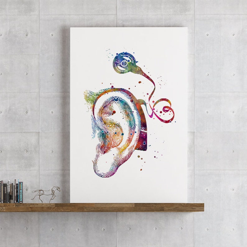 Cochlear Implant Poster Watercolor Art Print Hearing Loss - Etsy