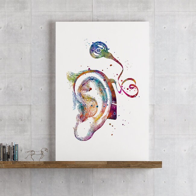 Cochlear Implant Poster Watercolor Art Print Hearing Loss - Etsy