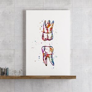 Dental Art | Maxillary and Mandibular Molar Tooth Multicolored ...