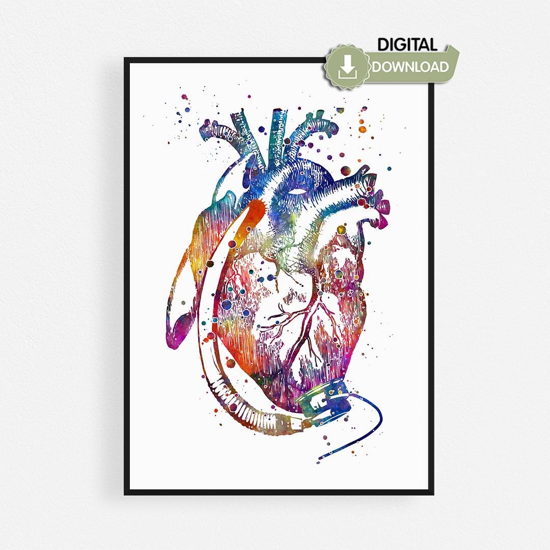 LVAD Heart Print, Watercolor Anatomical Heart With Ventricular Assist ...