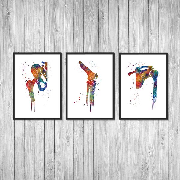 Orthopedic Poster - Etsy UK