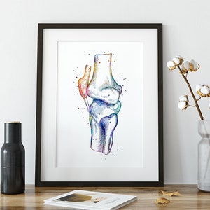 Knee Joint Anatomy Art Watercolor Print - Orthopedic Surgeon Gift ...