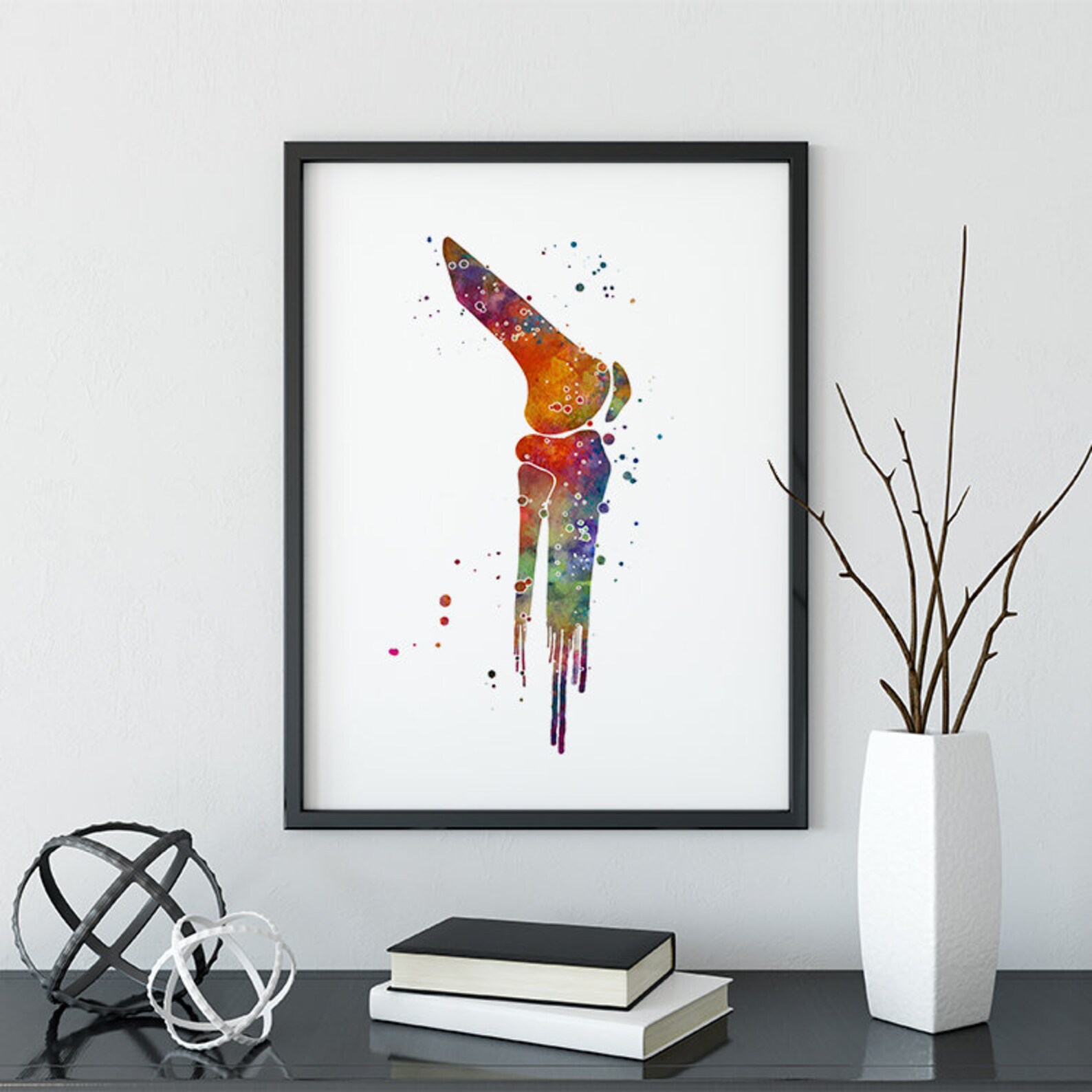 Knee Joint Anatomy Art Watercolor Print Orthopedic Surgeon | Etsy