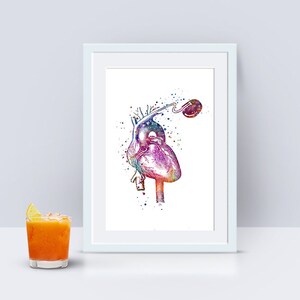 Heart Pacemaker Cardio Stimulator Watercolor Art Print - Etsy